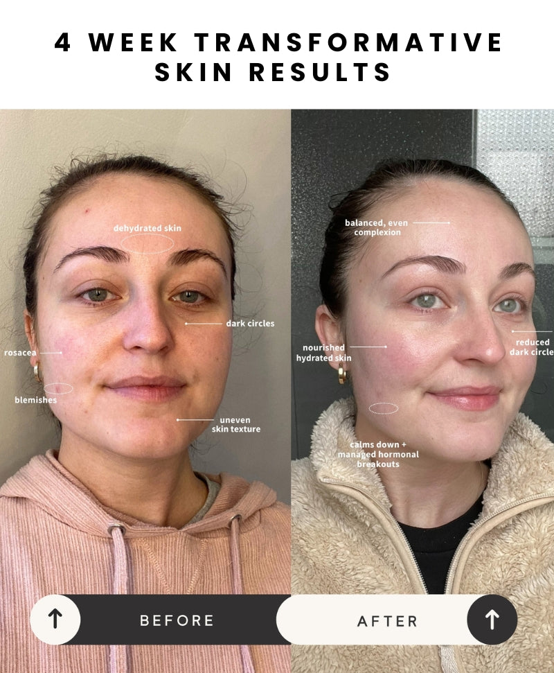 Elite LED Face Mask │ 8-Colour LEDs │ SENSSE BEAUTY – Sensse Beauty